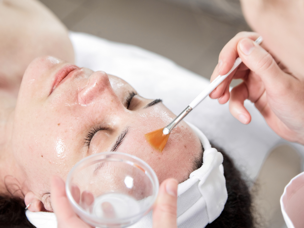 Medical Chemical Peels | Ultimate Aesthetics Medical Chemical Peels | Ultimate Aesthetics